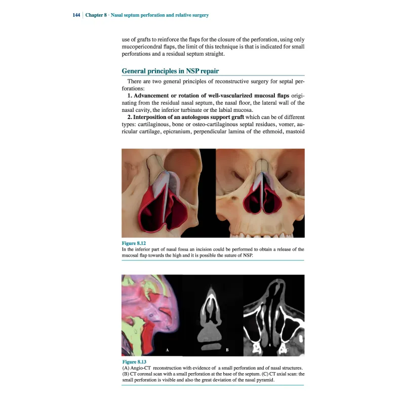 The Nasal Septum - Riccardo Nocini, Gabriele Molteni, Stelio Antonio ...